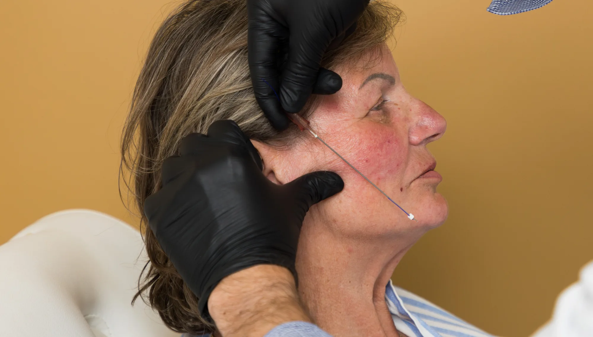 Lifting naturel sans chirurgie • Rajeunir votre peau en douceur avec ...